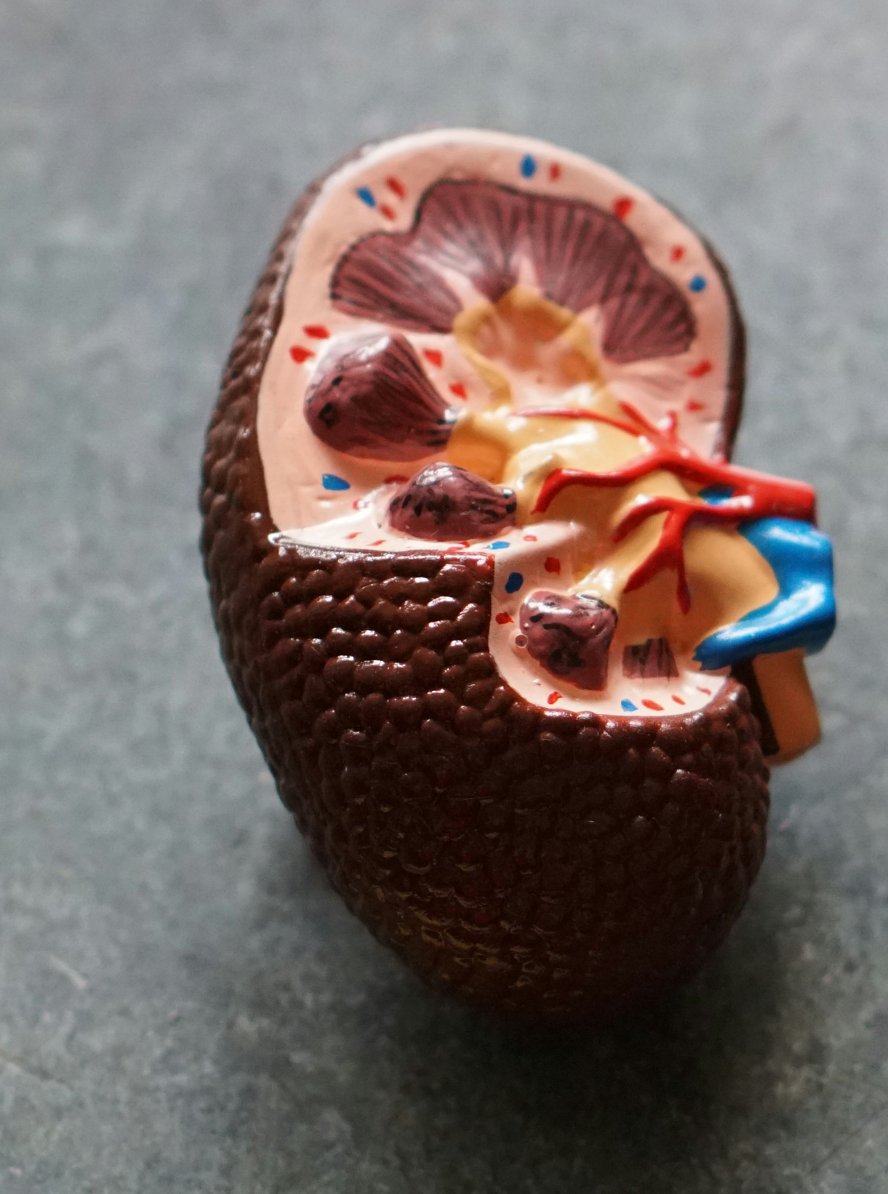AMKD Awareness Day: Raising Awareness for Kidney Disease | AFRO ...